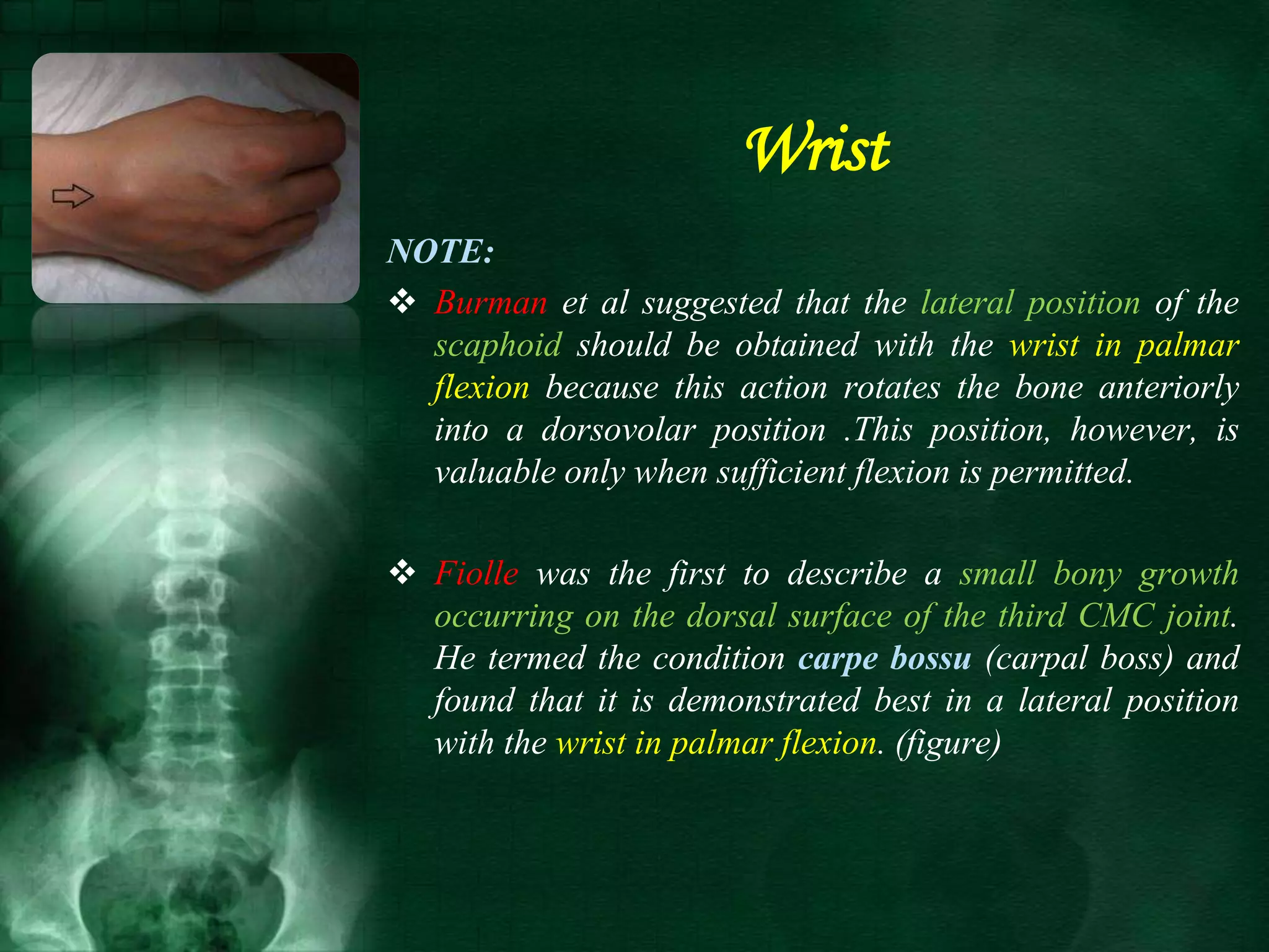 Technique 1 Upper limbs 1 | PPTX