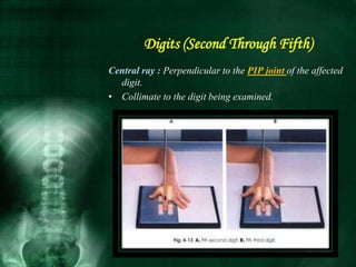 Technique 1 Upper limbs 1 | PPTX