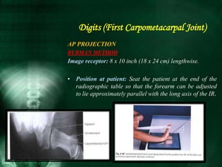 Technique 1 Upper limbs 1 | PPTX