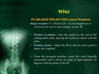 Technique 1 Upper limbs 1 | PPTX