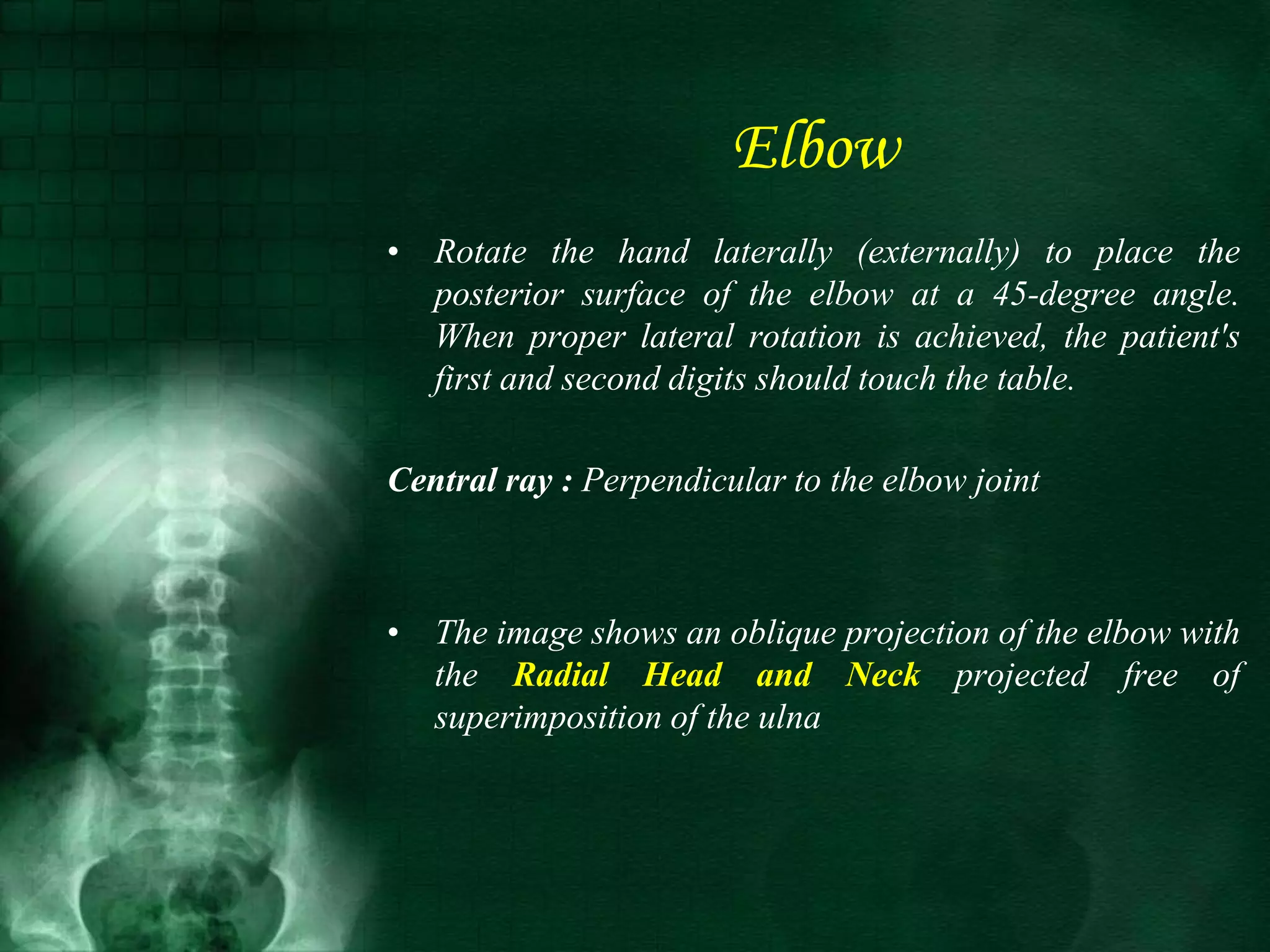 Technique 1 Upper limbs 2 | PPTX