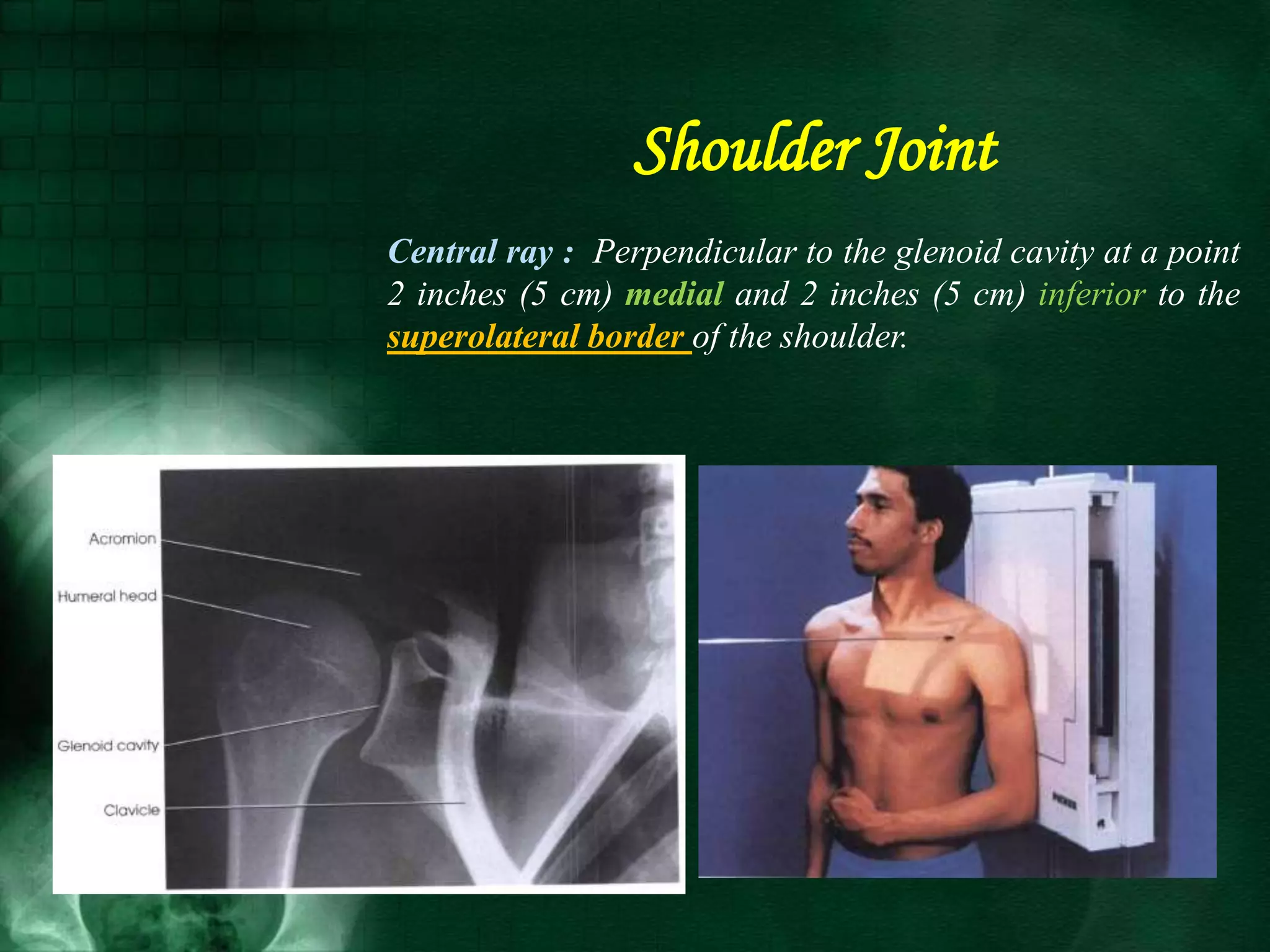 Technique 1 Upper limbs 3 | PPTX