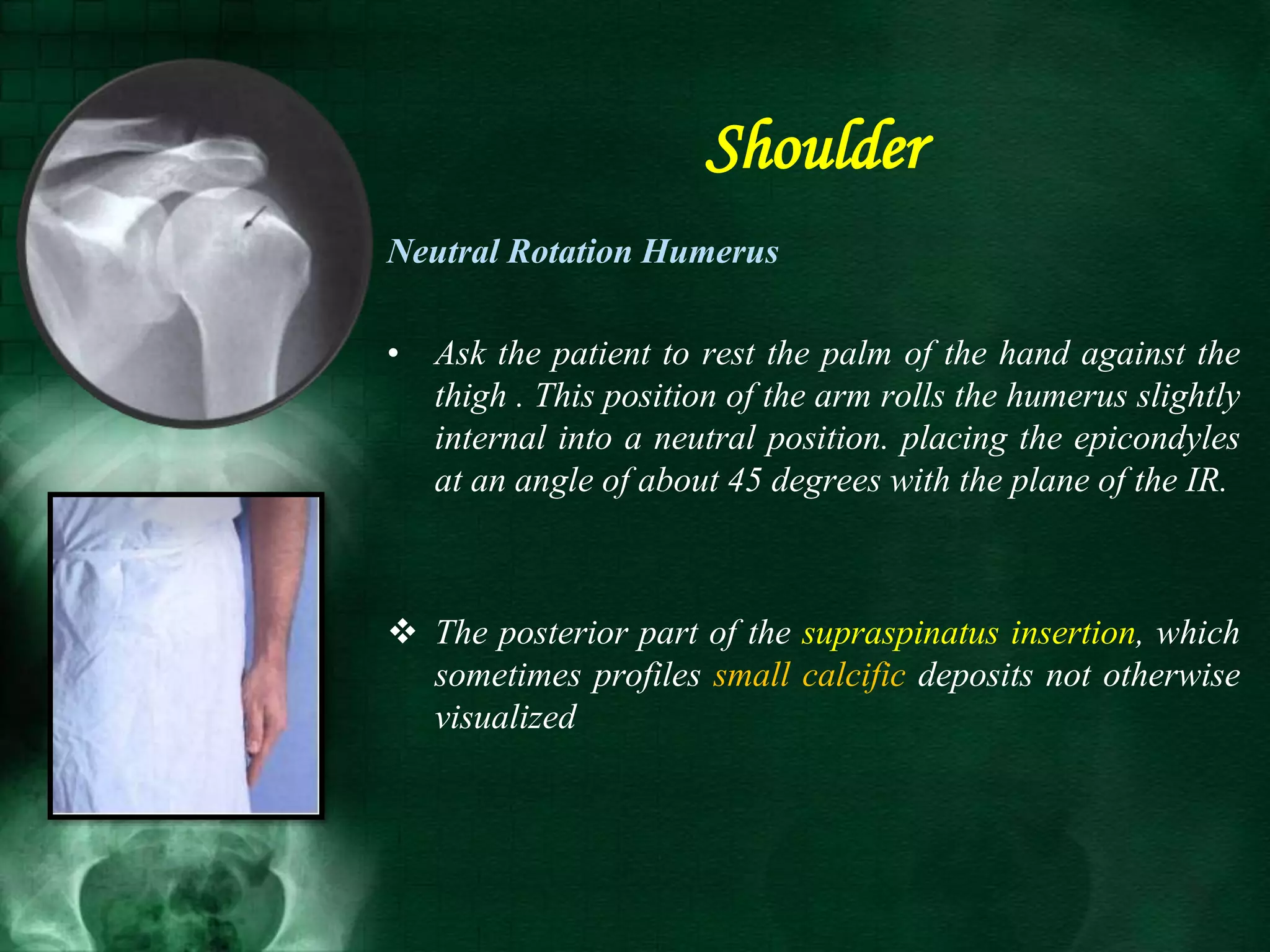 Technique 1 Upper limbs 3 | PPTX