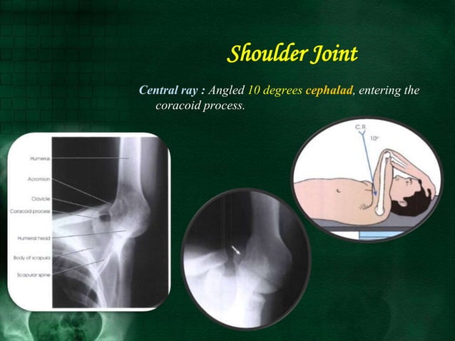 Technique 1 Upper limbs 3 | PPTX | Death, Injury, or Military Conflict ...