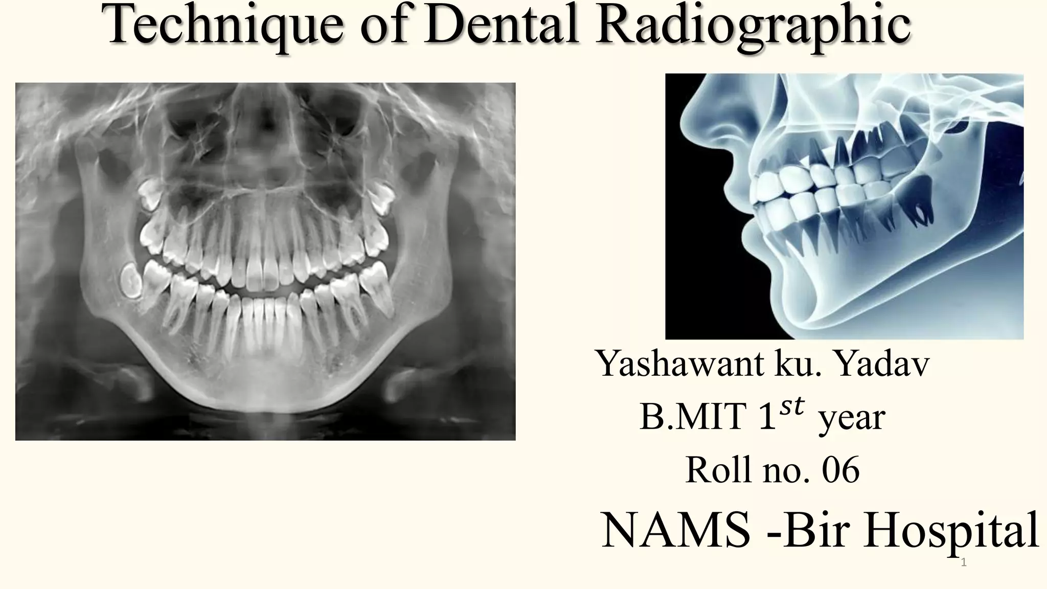 Technique of dental radiographic | PPTX
