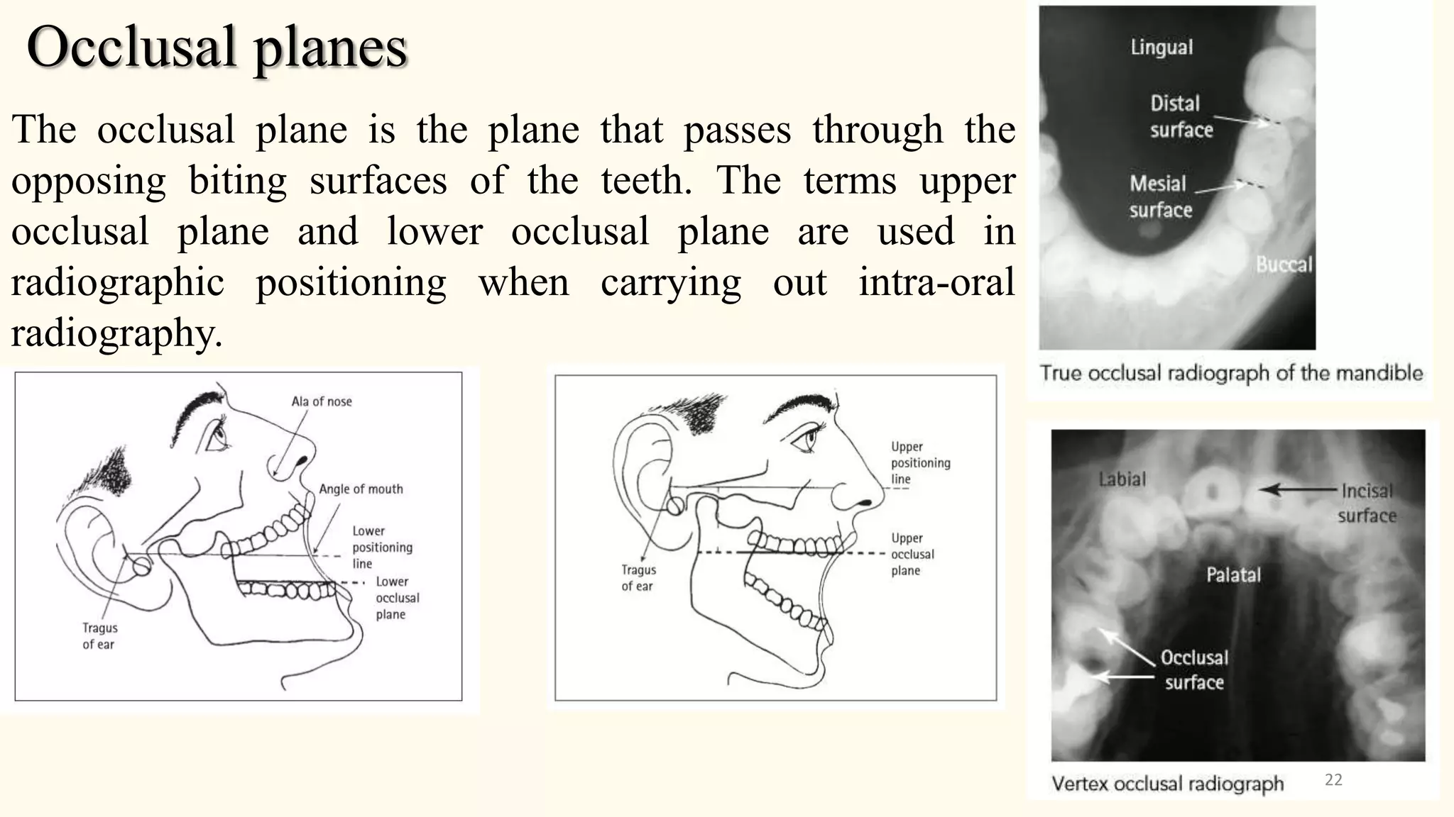 Technique of dental radiographic | PPTX