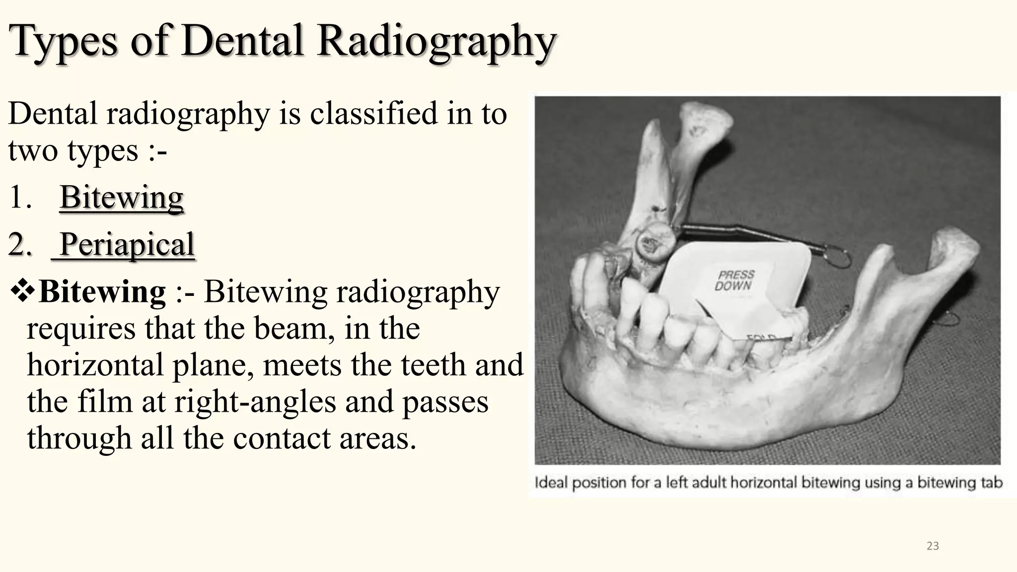 Technique of dental radiographic | PPTX