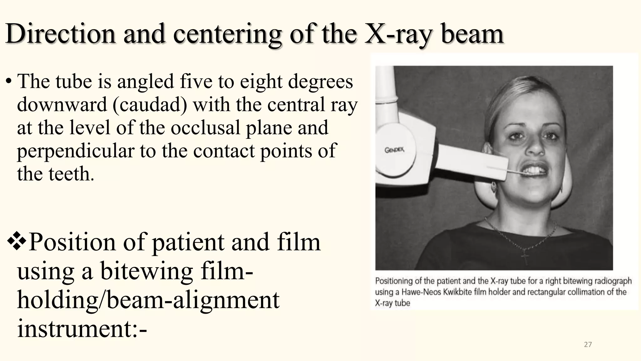 Technique of dental radiographic | PPTX
