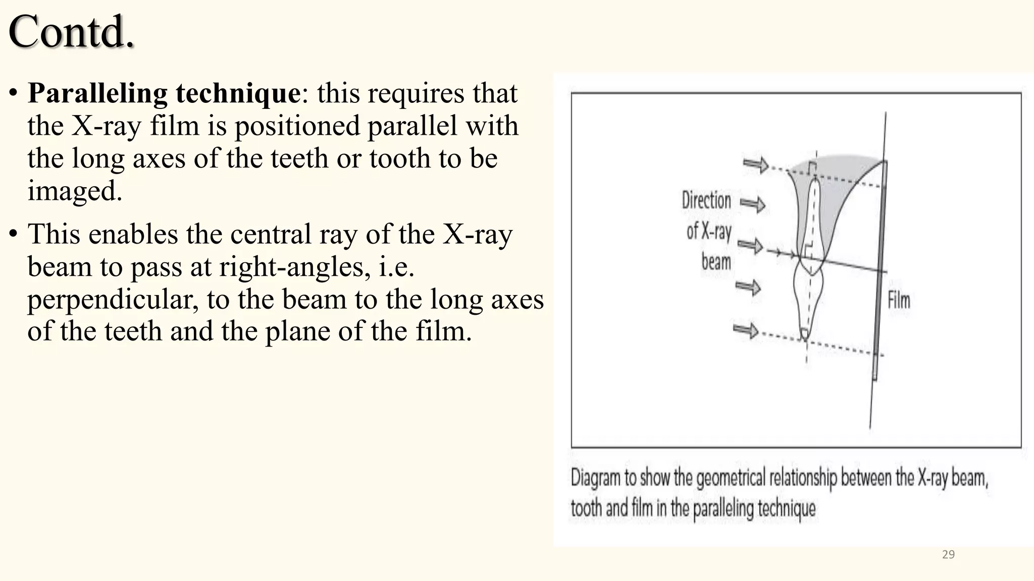 Technique of dental radiographic | PPTX