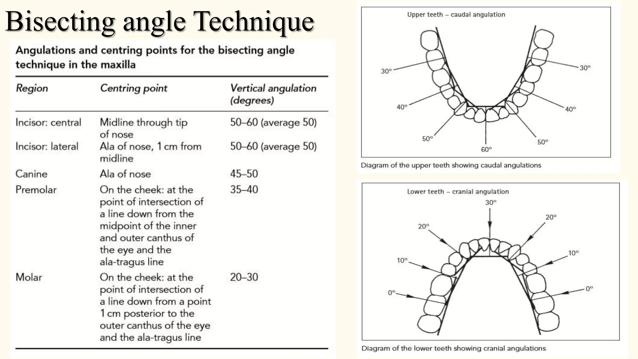 Technique of dental radiographic | PPTX