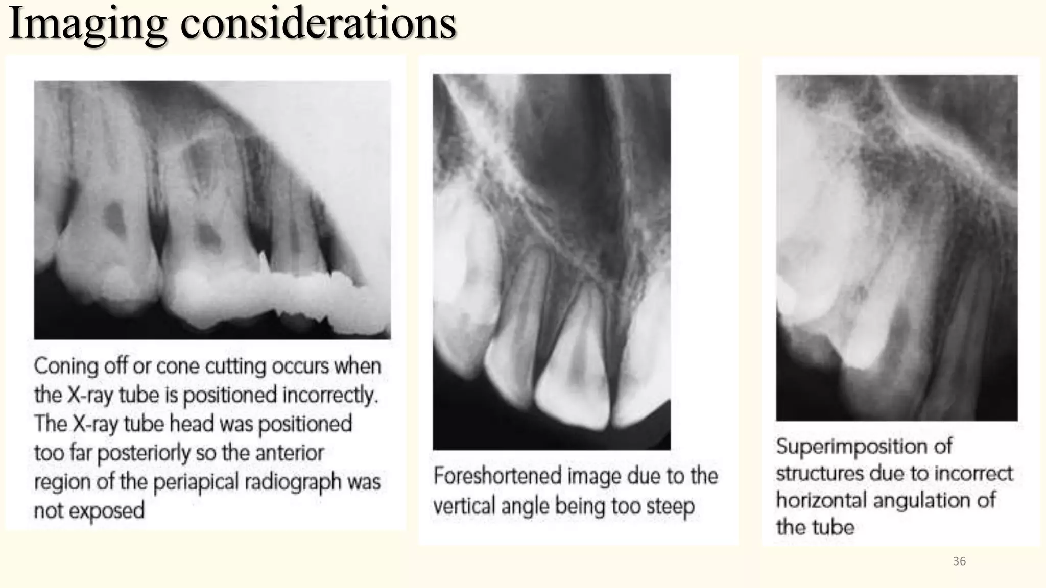 Technique of dental radiographic | PPTX
