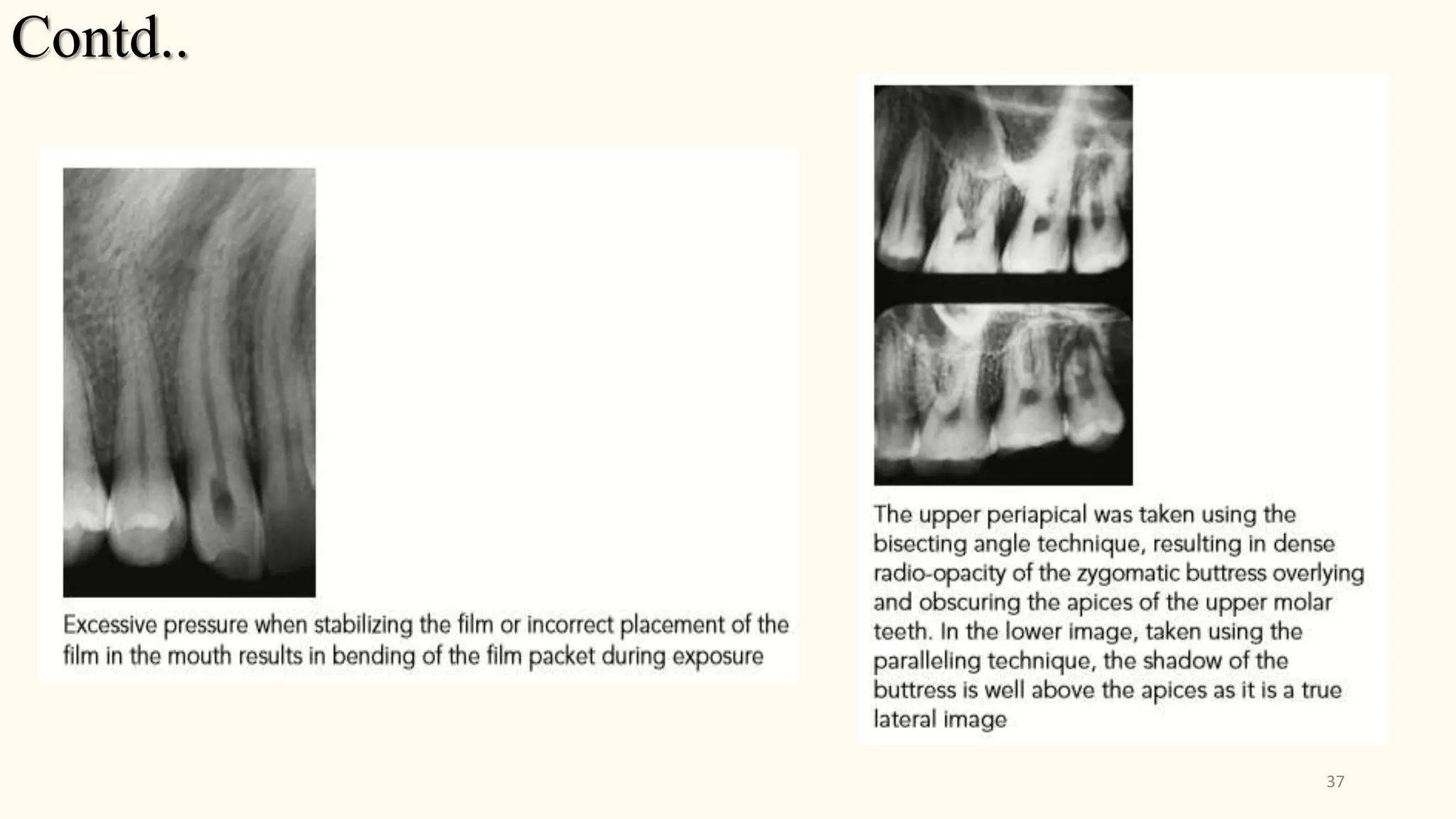 Technique of dental radiographic | PPTX