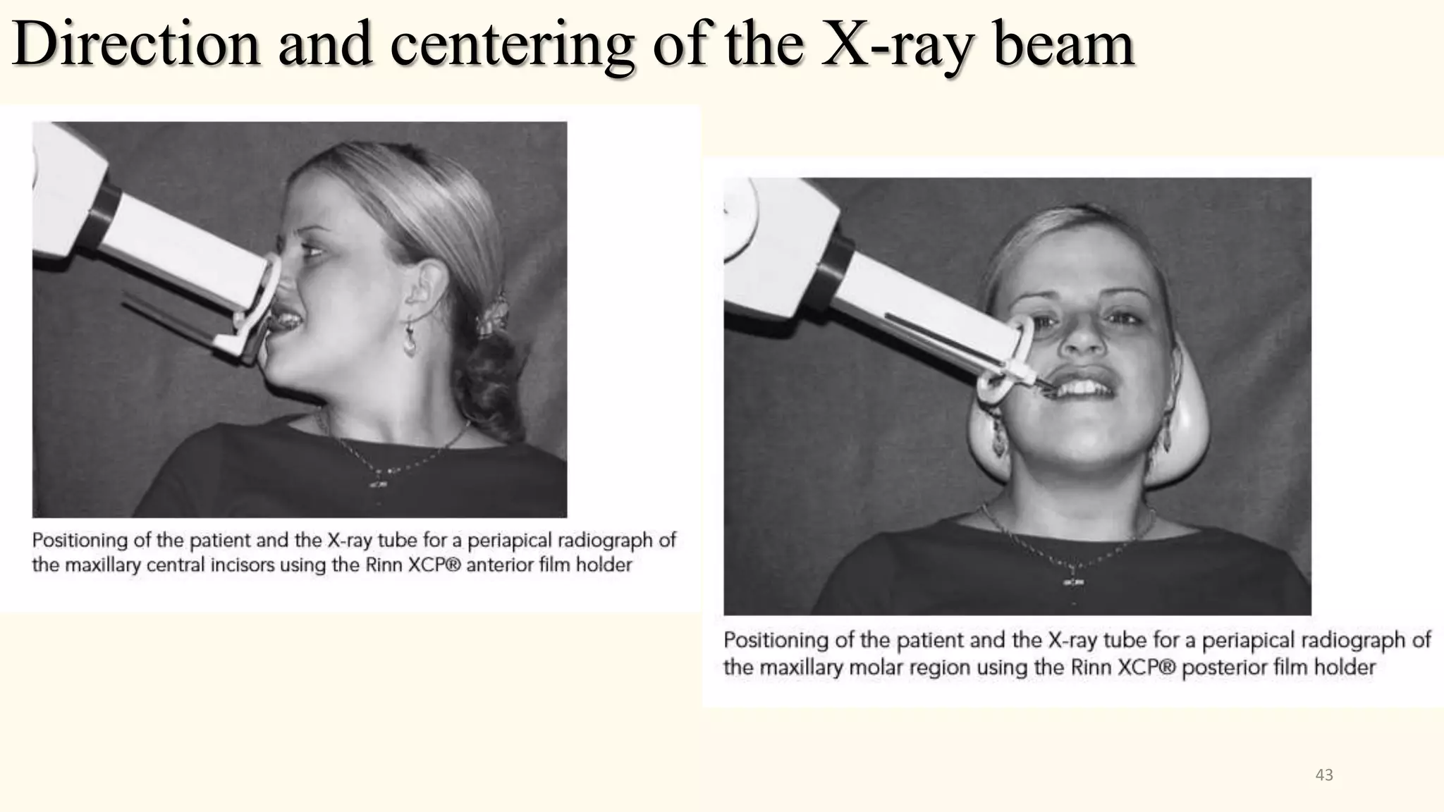 Technique of dental radiographic | PPTX