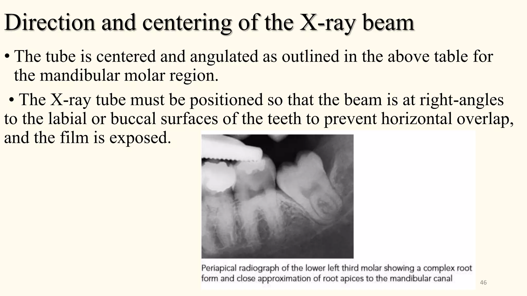 Technique of dental radiographic | PPTX
