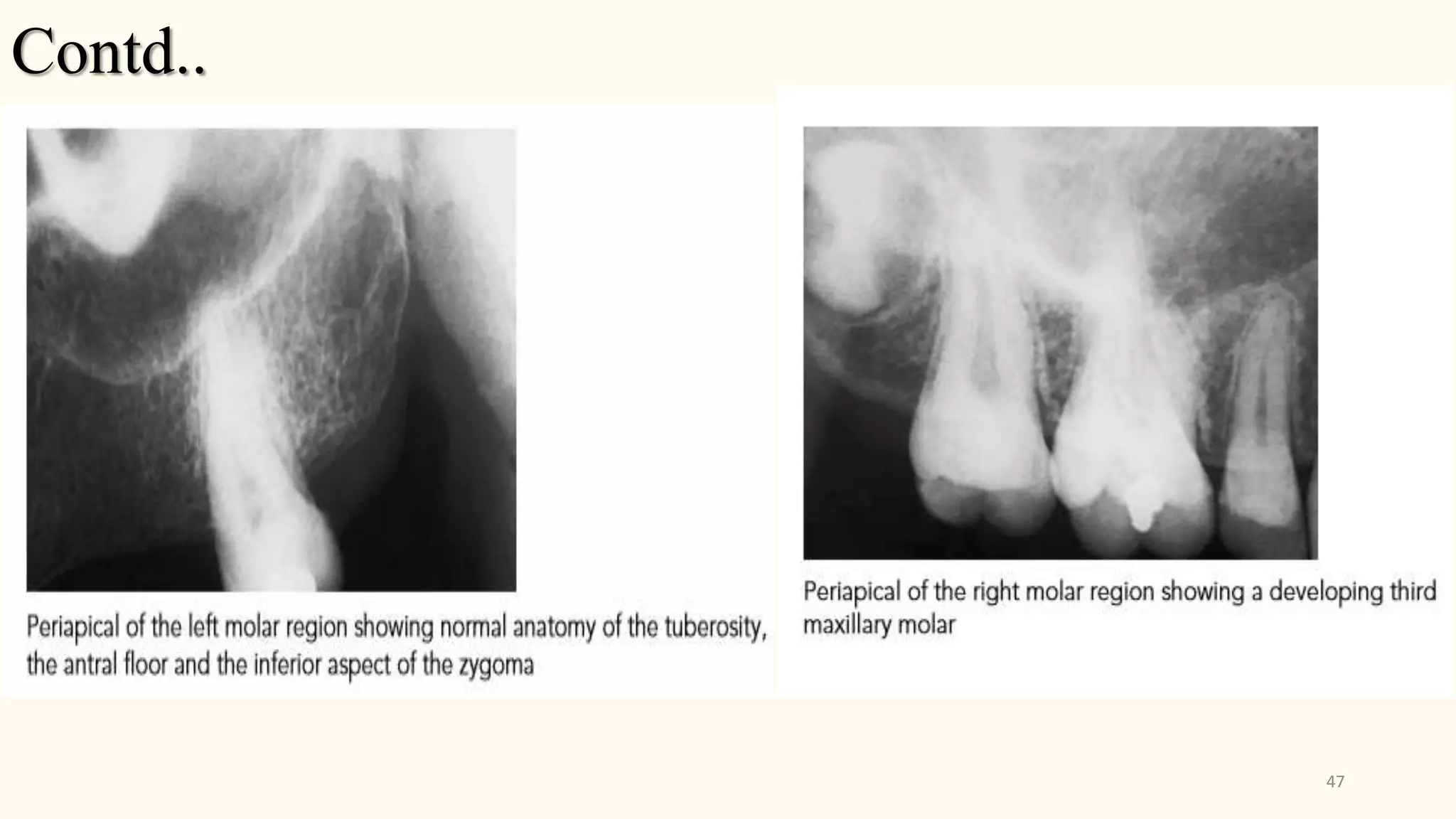 Technique of dental radiographic | PPTX