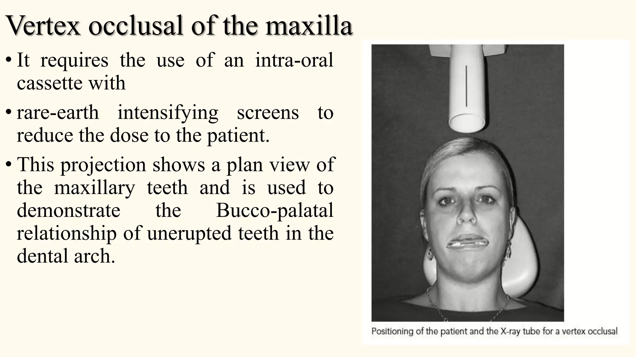 Technique of dental radiographic | PPTX