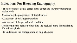 Technique of dental radiographic | PPTX