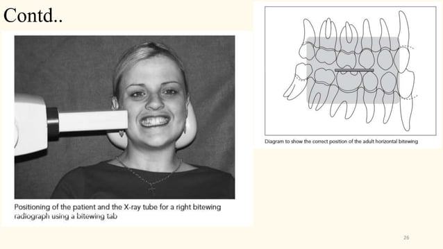 Technique of dental radiographic | PPTX