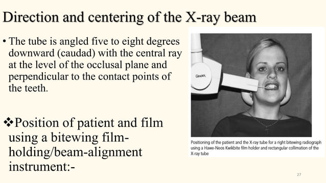 Technique of dental radiographic | PPTX