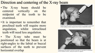 Technique of dental radiographic | PPTX