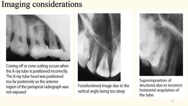 Technique of dental radiographic | PPTX