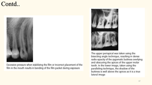 Technique of dental radiographic | PPTX