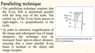 Technique of dental radiographic | PPTX