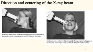 Technique of dental radiographic | PPTX