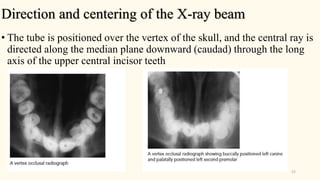 Technique of dental radiographic | PPTX