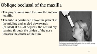 Technique of dental radiographic | PPTX