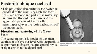 Technique of dental radiographic | PPTX