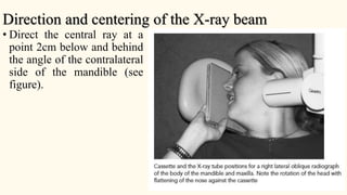 Technique of dental radiographic | PPTX