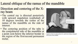 Technique of dental radiographic | PPTX