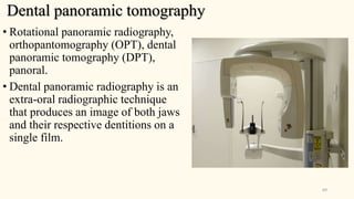 Technique of dental radiographic | PPTX