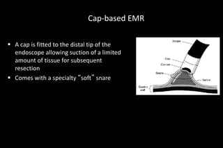 Technique of eet | PPT