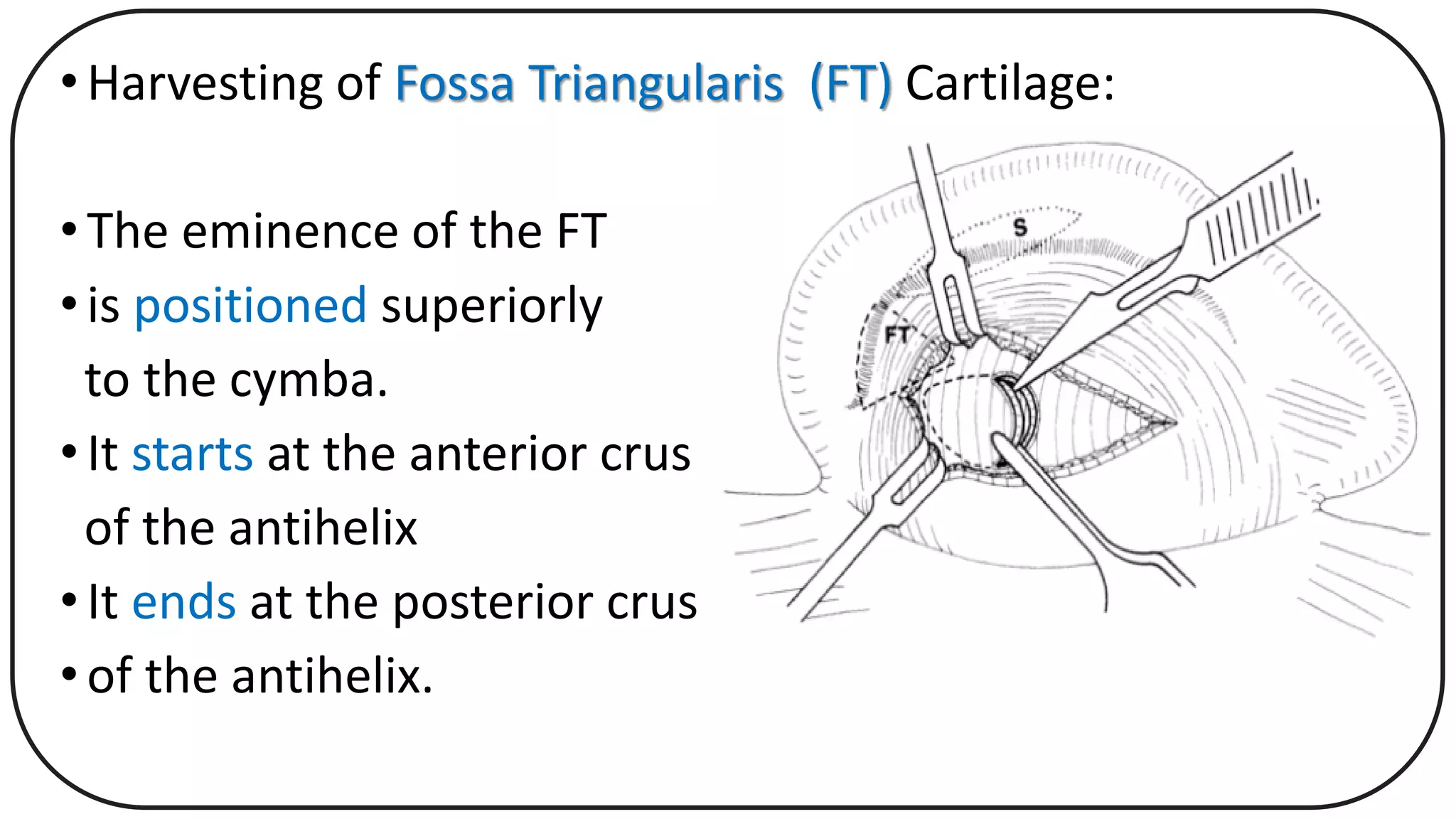 Technique of harvesting cartilage graft for cartilage tympanoplasty Dr ...