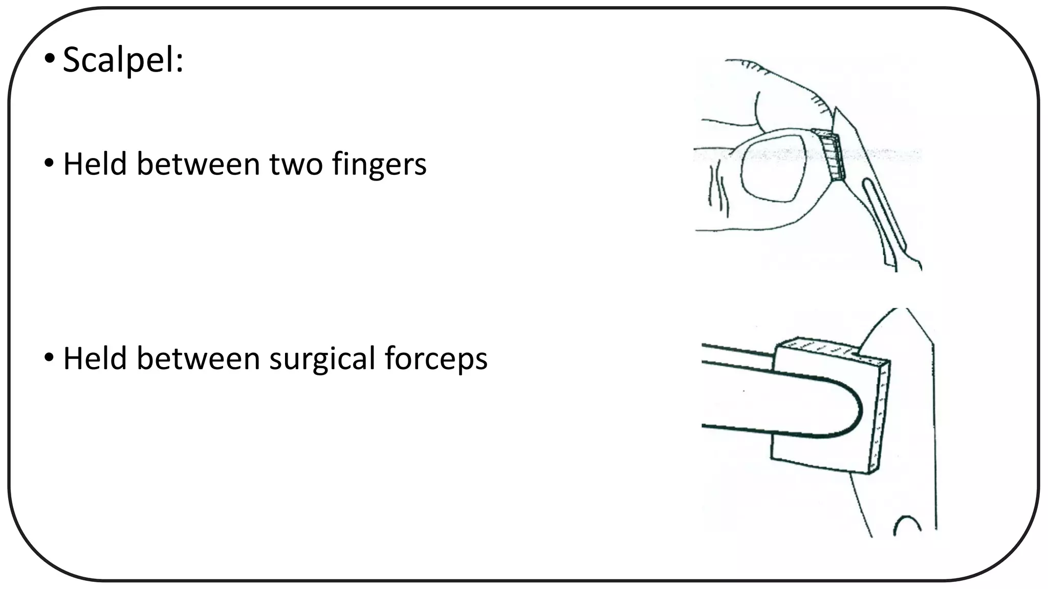 Technique of harvesting cartilage graft for cartilage tympanoplasty Dr ...