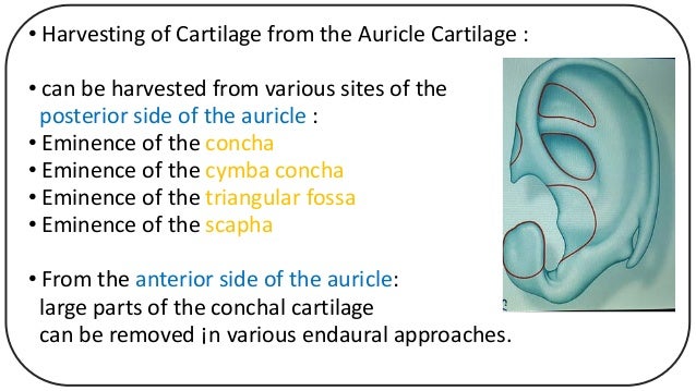 Technique of harvesting cartilage graft for cartilage tympanoplasty