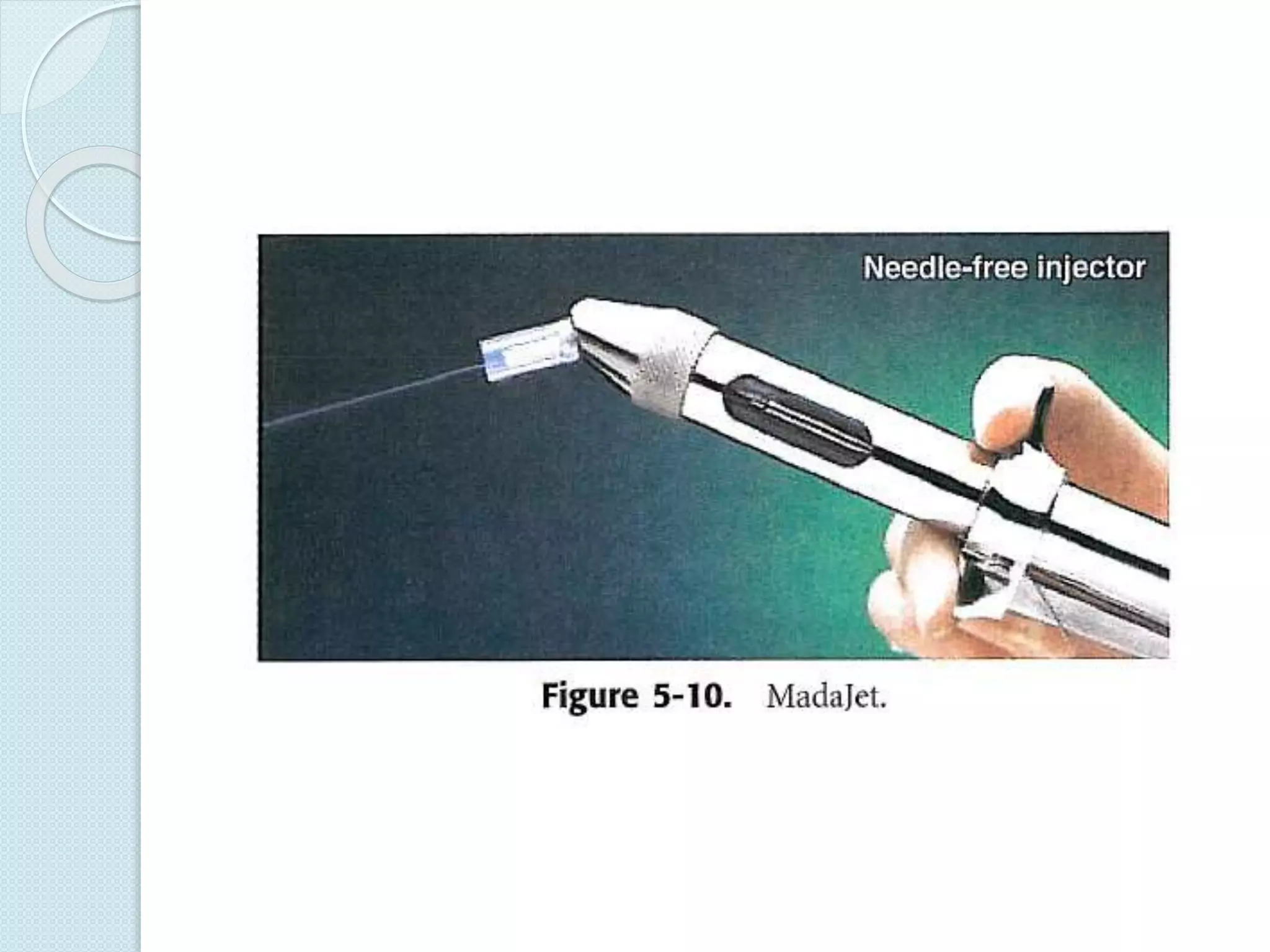 Technique of mandibular anesthesia | PPTX