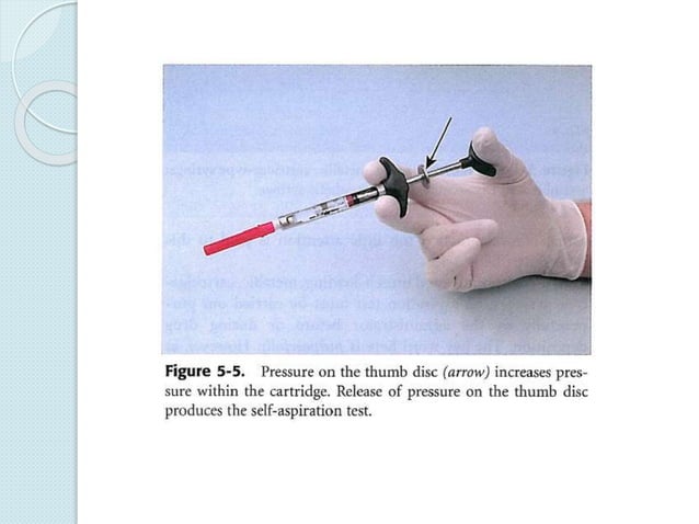 Technique of mandibular anesthesia | PPTX