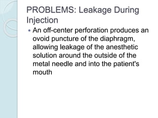 Technique of mandibular anesthesia | PPTX