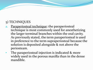 Technique of maxillay anesthesia | PPTX