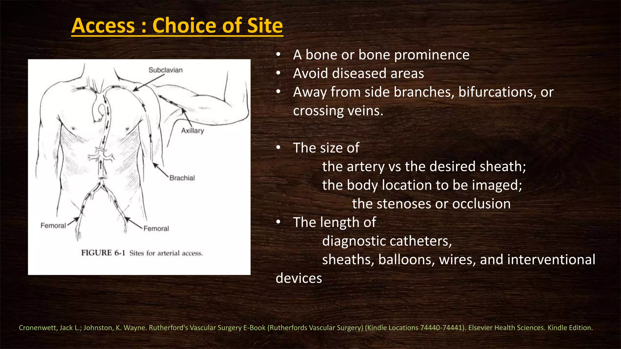 Technique of peripheral angiogram and complication | PPTX