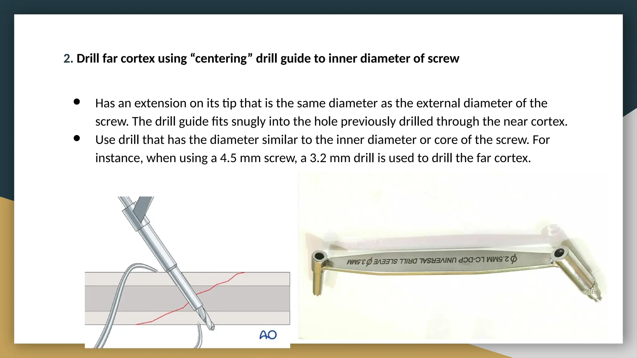Technique of Plating & Lag screw slide sahre | PPTX