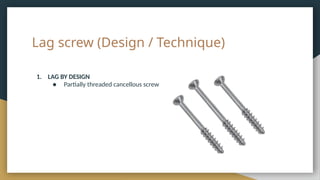 Technique of Plating & Lag screw slide sahre | PPTX