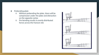 Technique of Plating & Lag screw slide sahre | PPTX