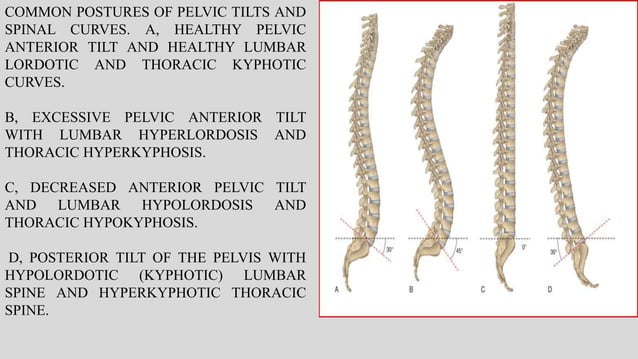 Technique of thoracic and lumber spine radiography | PPTX