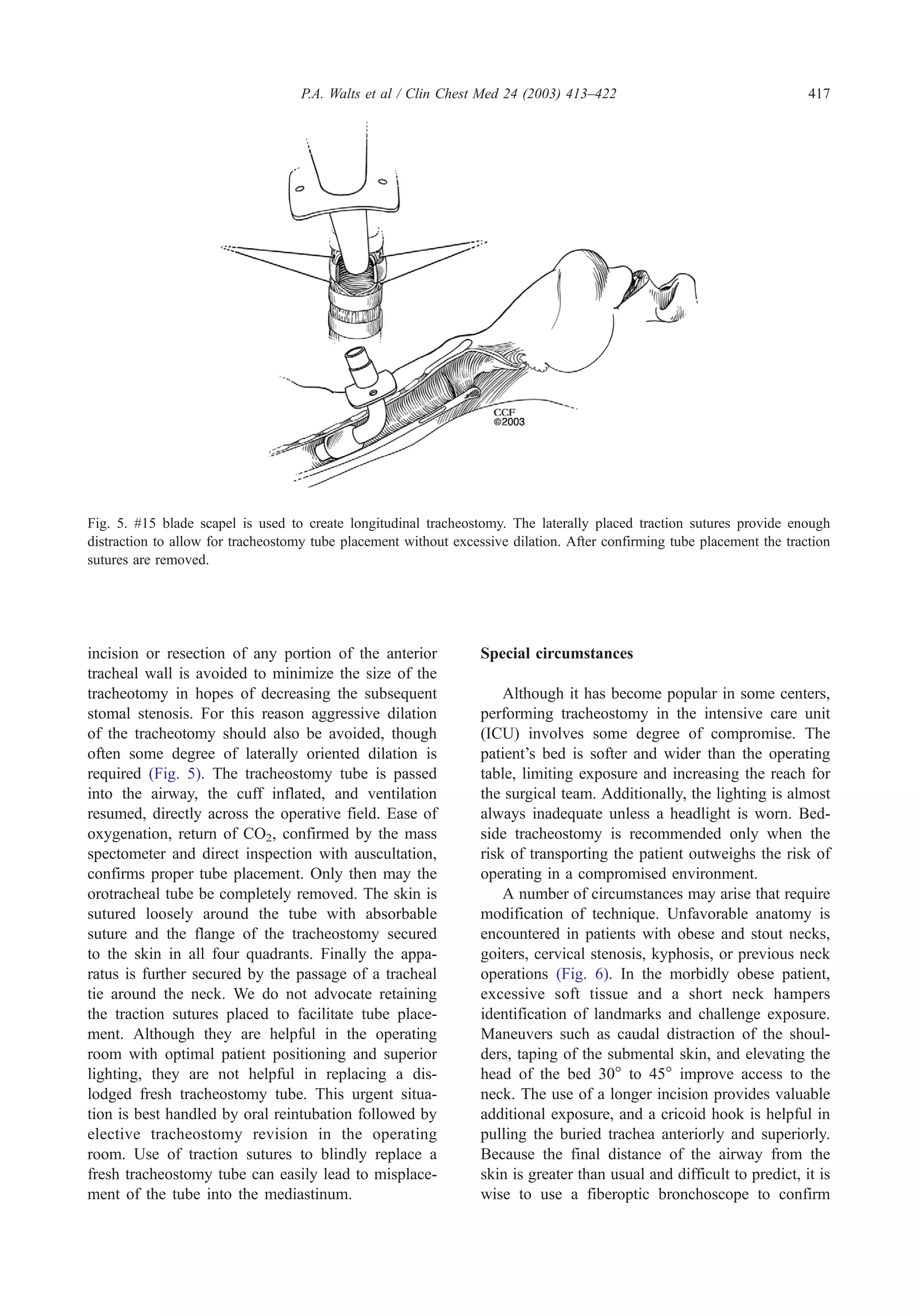 Technique of tracheostomy | PDF | Ear, Nose and Throat Conditions ...