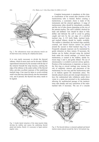 Technique of tracheostomy | PDF | Ear, Nose and Throat Conditions ...