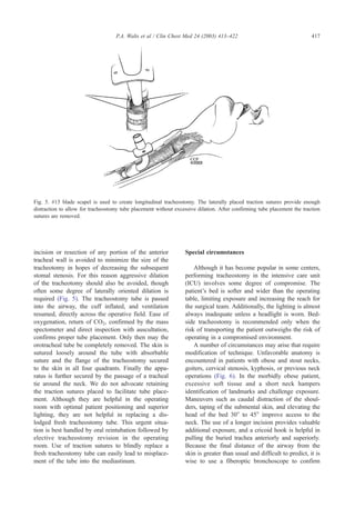 Technique of tracheostomy | PDF | Ear, Nose and Throat Conditions ...